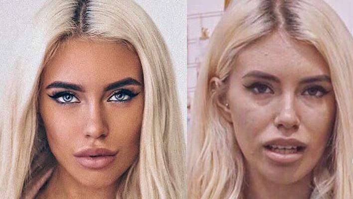 ‘Beauty False’: la cuenta de Instagram que expone la verdadera belleza ...