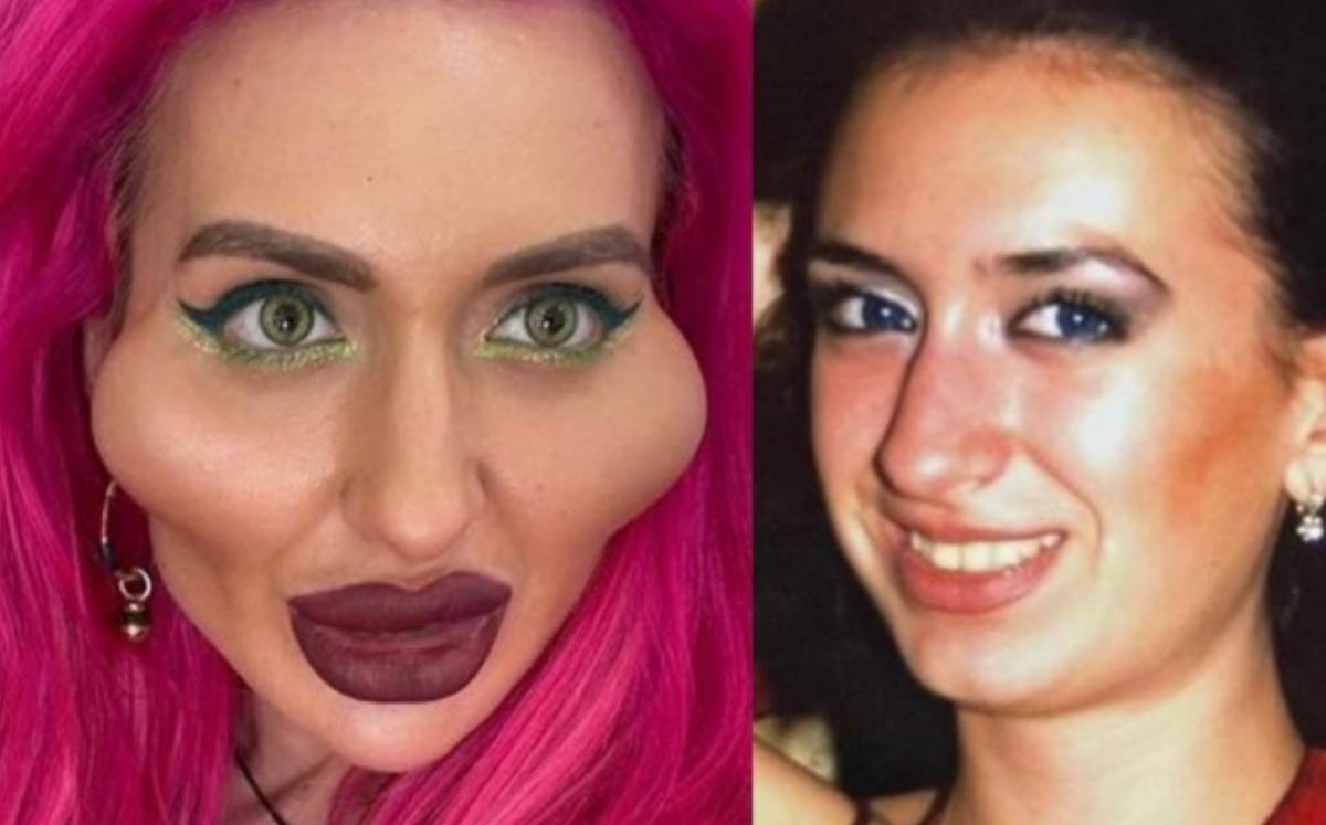 ¡IMPRESIONANTE! Joven busca ser la mujer con los cachetes más grandes ...