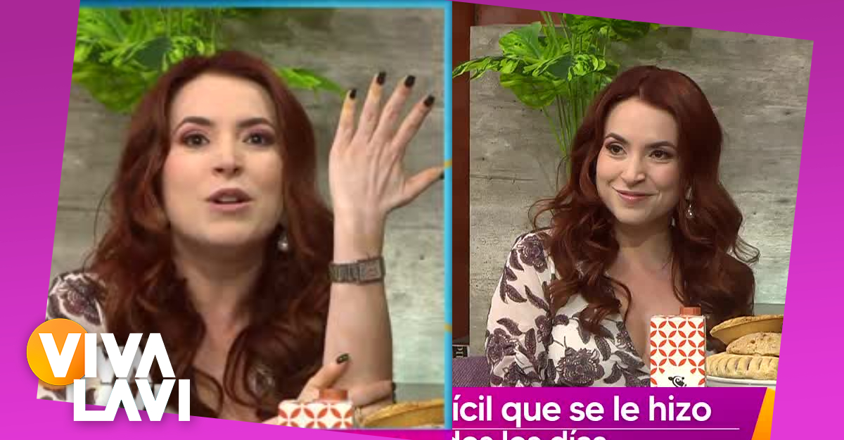 Alexia Almeida rompe el silencio sobre su vitiligo